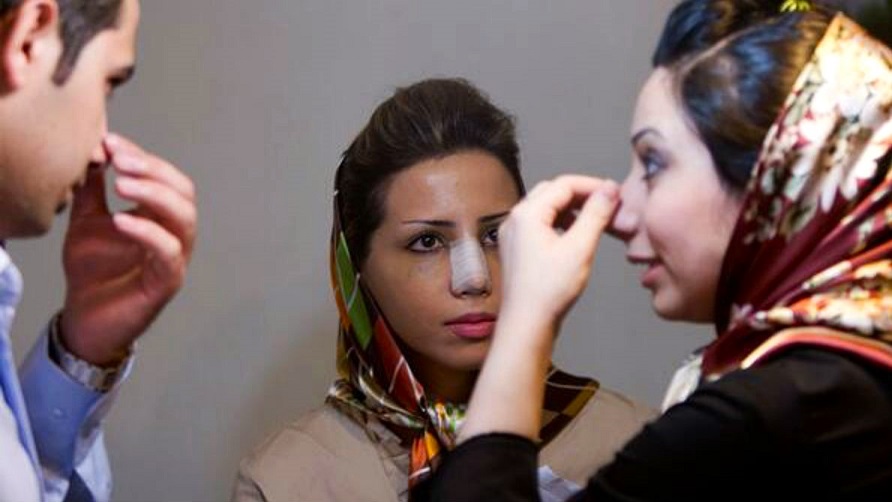 Iran lowers minimum age for cosmetic surgery
